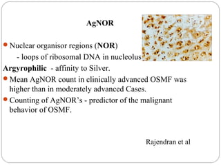 ETIOPATHOGENESIS OF OSMF | PPT