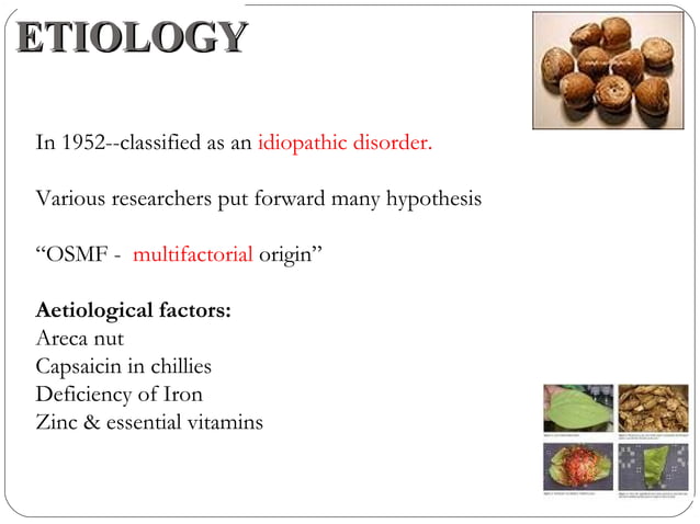 ETIOPATHOGENESIS OF OSMF | PPT