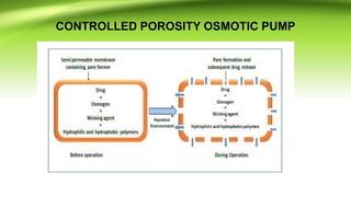 Osmotic Pressure Controled Drug Delivery System | PPTX