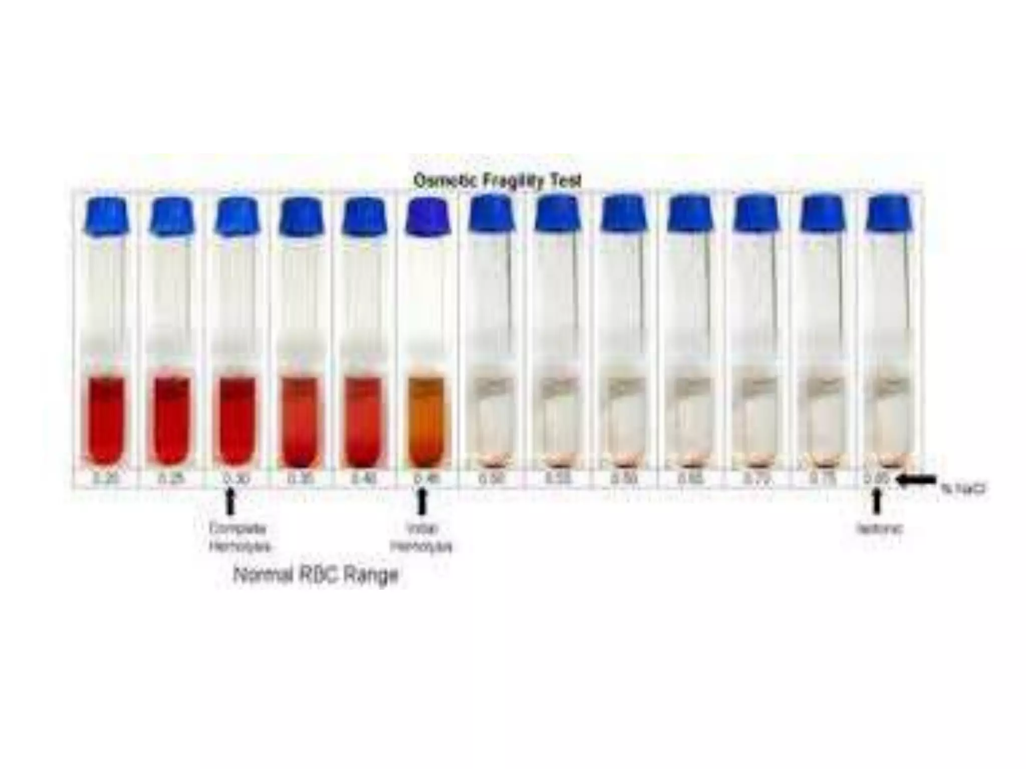 Osmotic fragility of red blood cells by Pandian M | PPTX