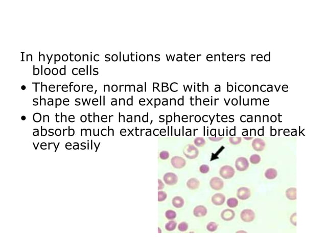 Osmotic fragility of red blood cells.ppt