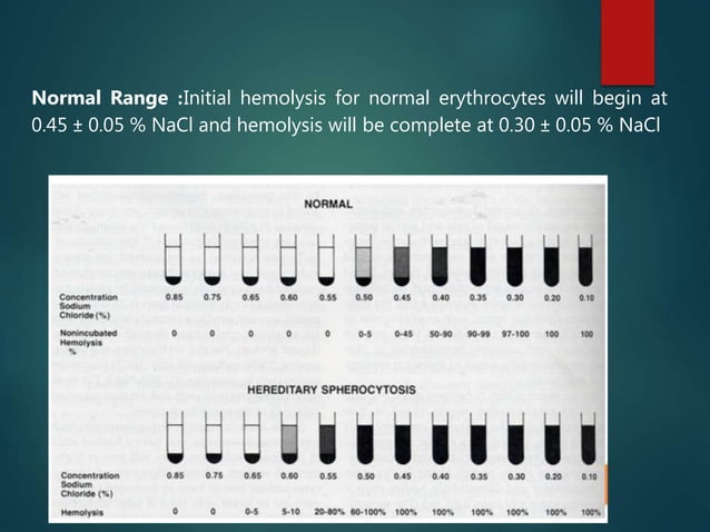 Osmotic fragility & rbc membrane defects 050916 | PPTX | Blood ...