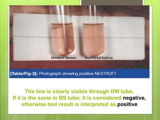 Osmotic fragility test | PPTX
