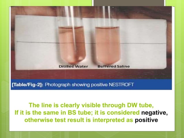 Osmotic fragility test | PPTX | Blood Disorders | Diseases and Conditions