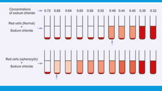 Osmotic Fragility Test | PPTX