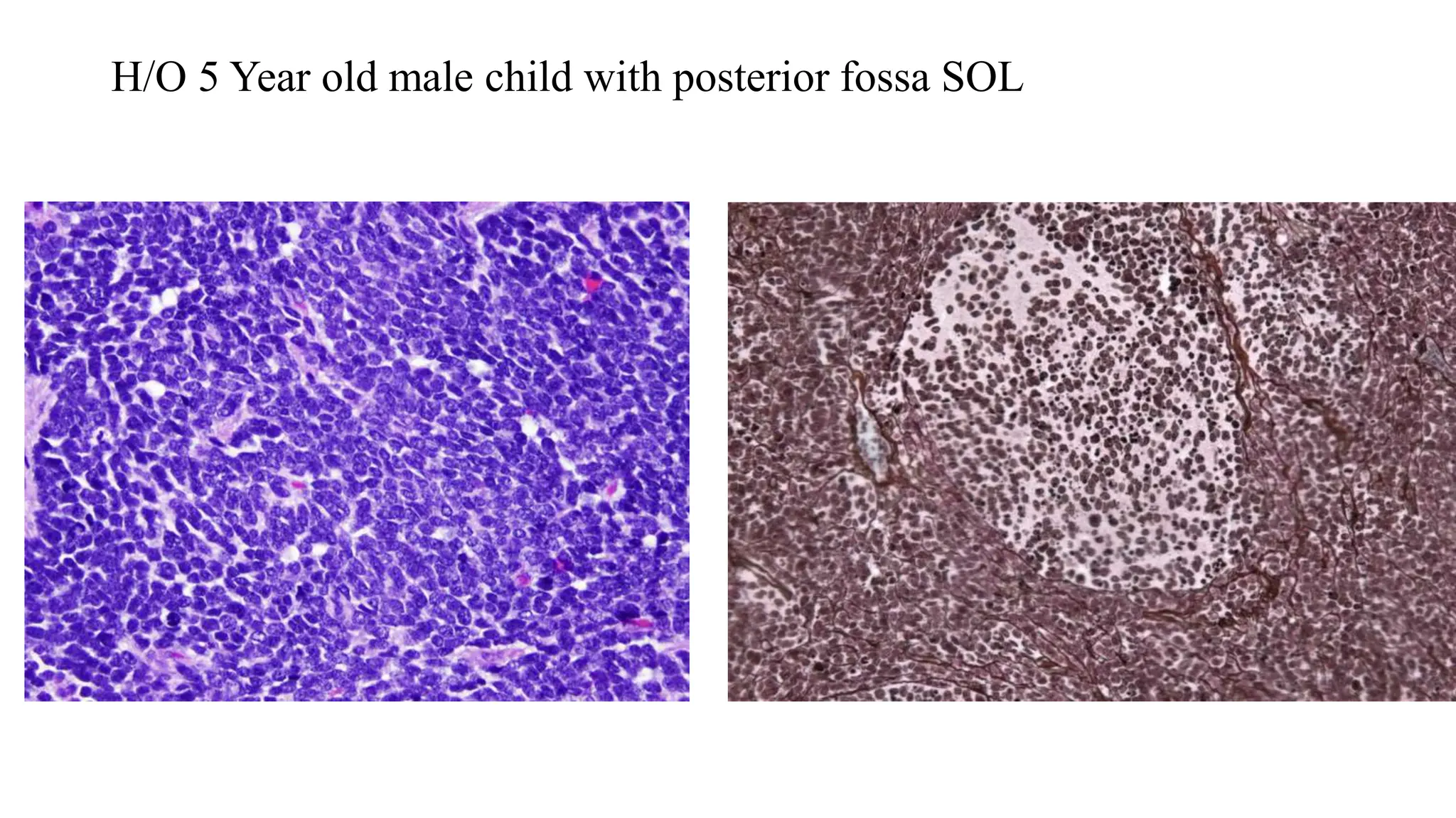 OSPE Charts for pathology PGs , Charts and keys | PPTX