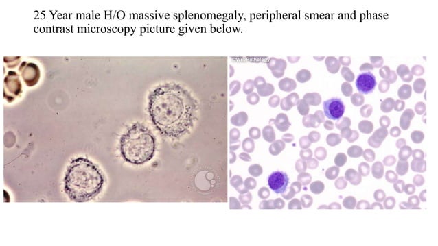 OSPE Charts for pathology PGs , Charts and keys | PPTX