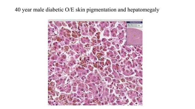 OSPE Charts for pathology PGs , Charts and keys | PPTX