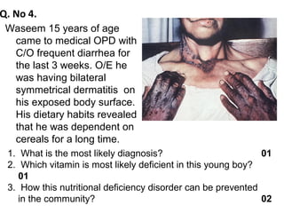 OSE in Public Health | PPT