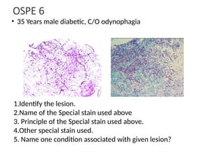 ospe final efefefeefwfwihigigigivith key.pptx