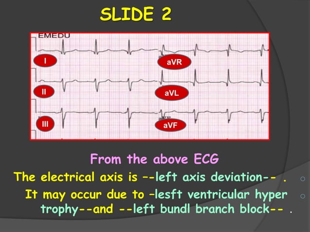 Ospe med 32 with answers | PPTX | Heart and Cardiovascular Diseases ...