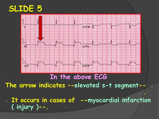 Ospe med 32 with answers | PPTX | Heart and Cardiovascular Diseases ...