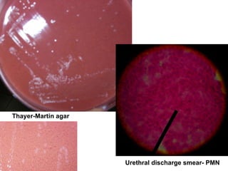 Microbiology slides part 2 | PPT