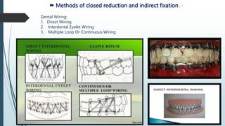 Oral Surgery Presentation Dental 3rd Year | PPTX