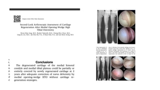 Dr.Rama Kartheek presentation in OSSAP con for Patho Anatomy of osteoarthritis | PPT