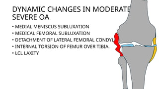 Dr.Rama Kartheek presentation in OSSAP con for Patho Anatomy of osteoarthritis | PPT
