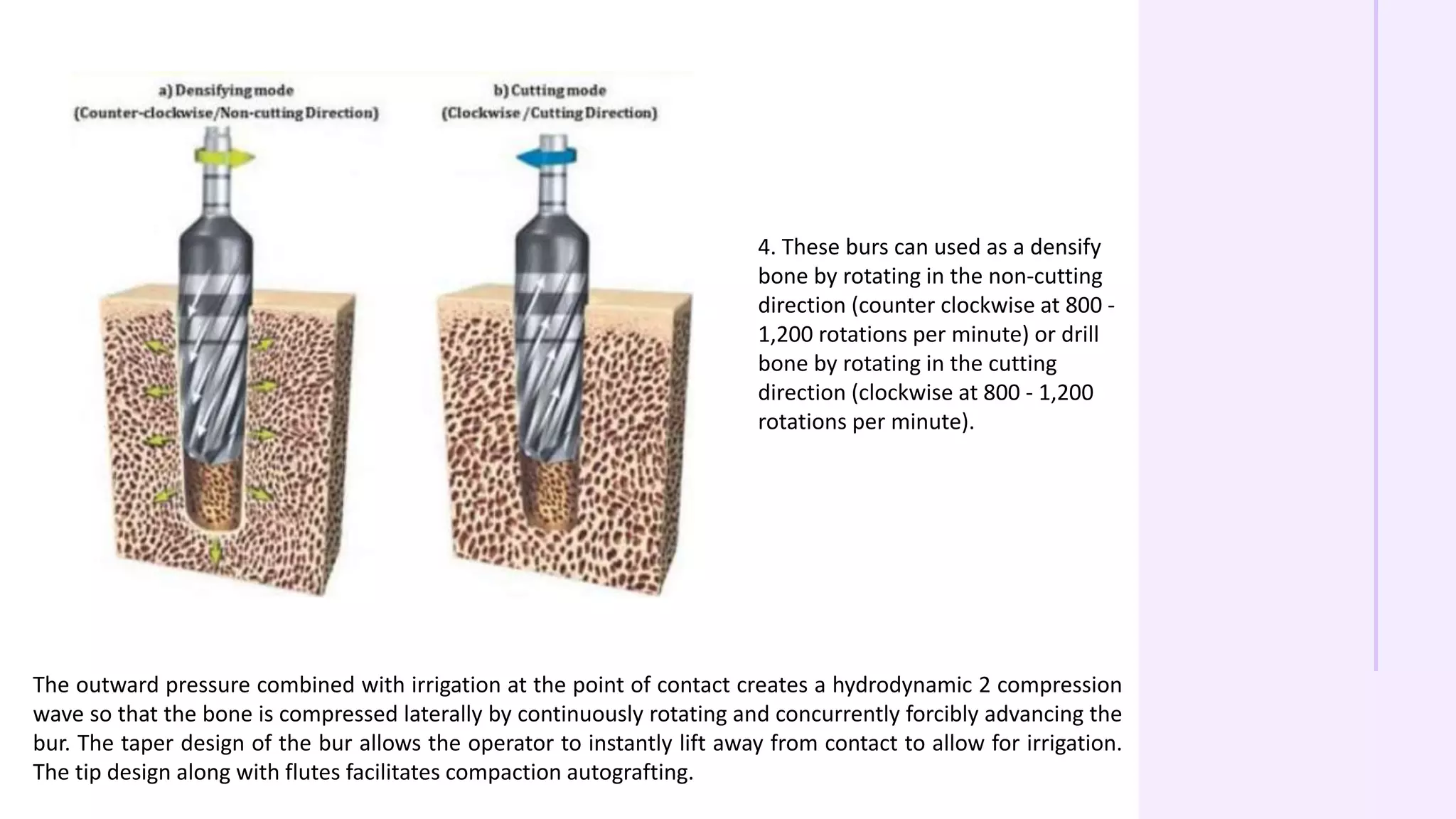 osseodensification.pptx