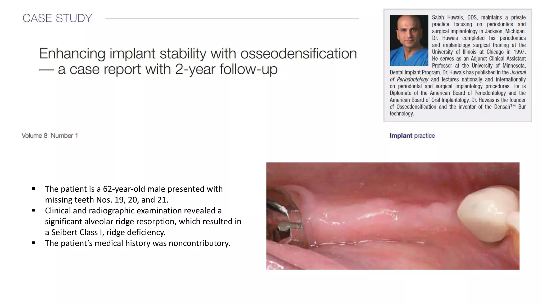 osseodensification.pptx