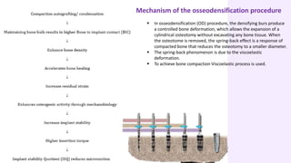 osseodensification.pptx