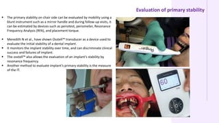 osseodensification.pptx