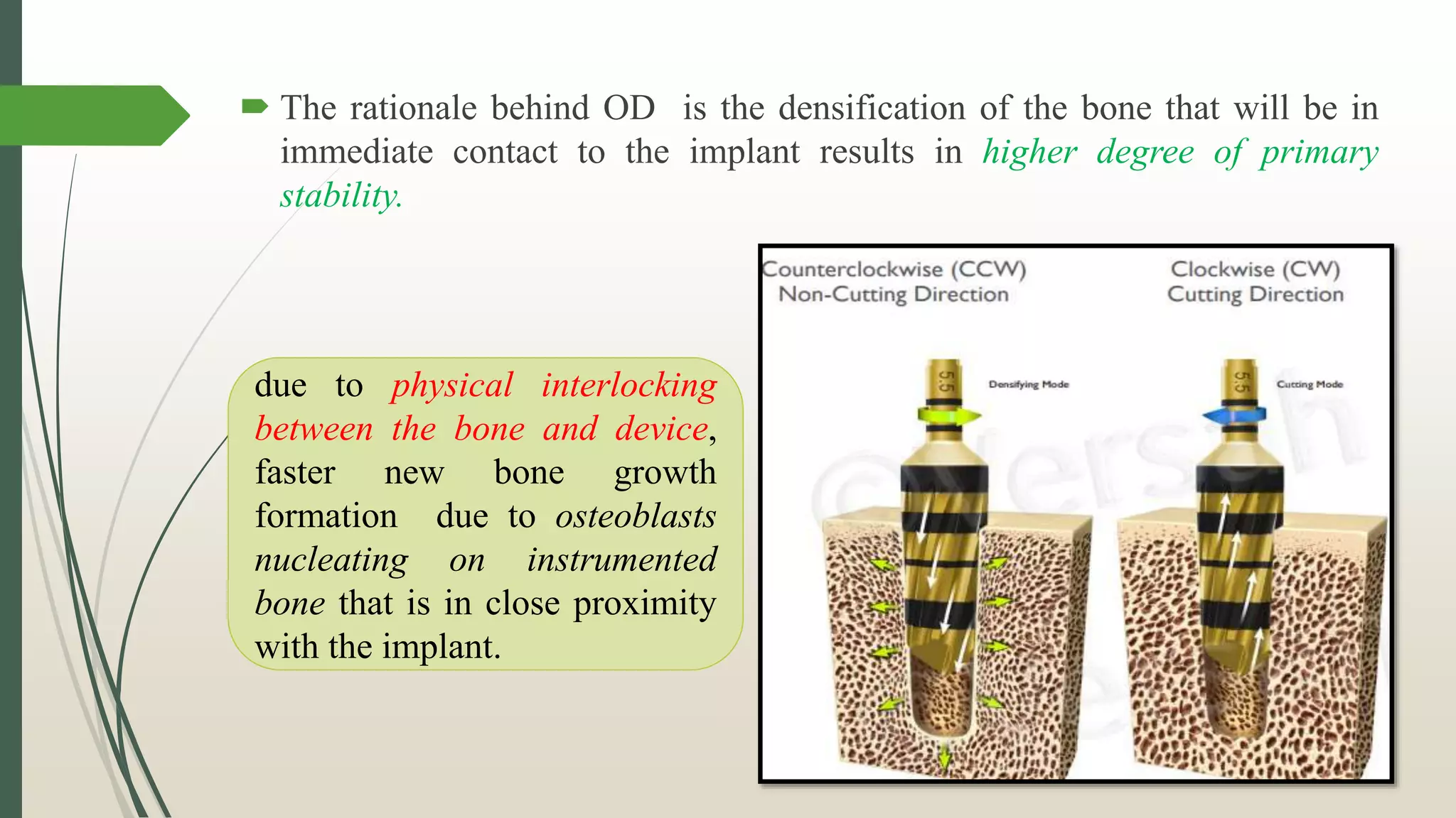 Osseodensification | PPTX