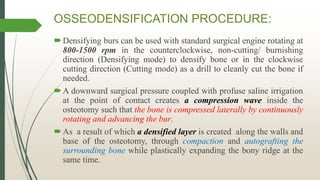 Osseodensification | PPTX