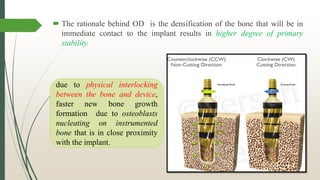 Osseodensification | PPTX