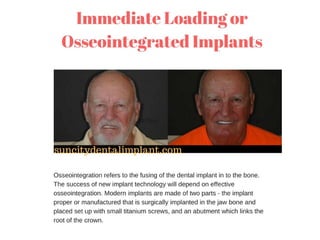 Osseointegrated implants | PPT | Operating Systems | Computer Software ...