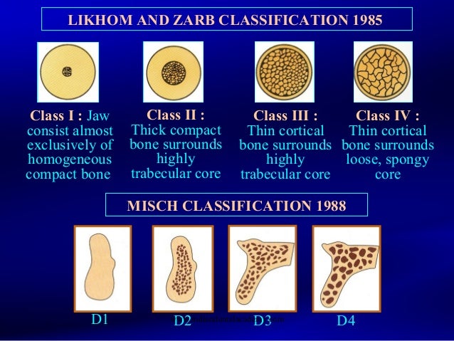 Osseointegration/ orthodontic continuing education