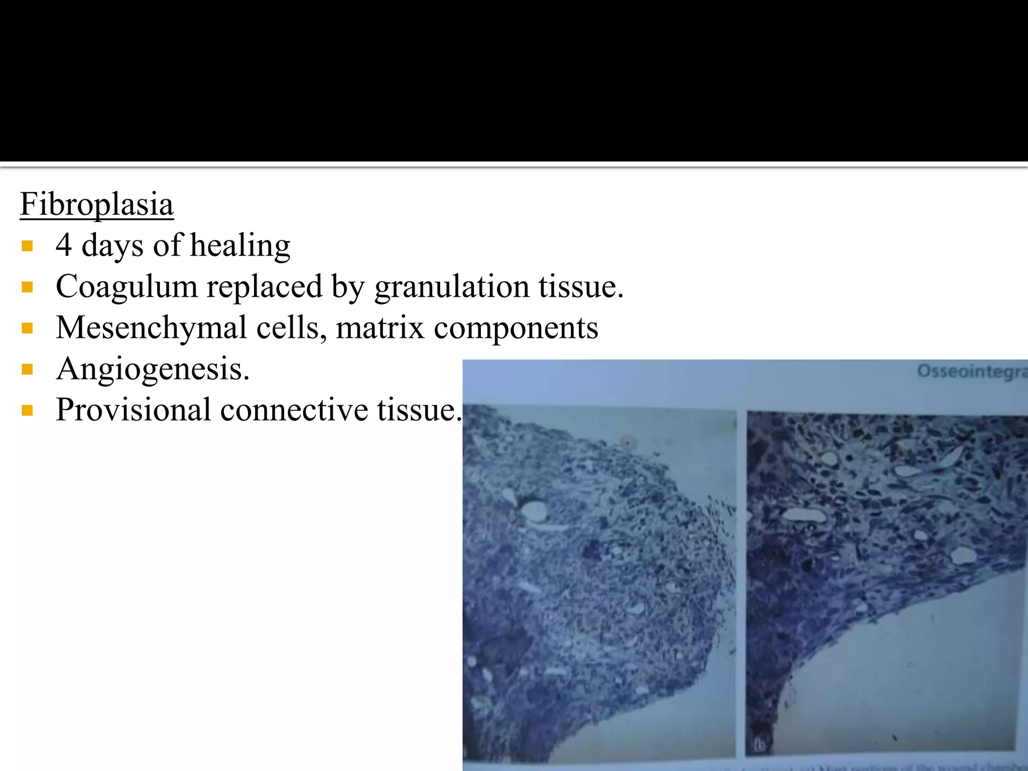 "OSSEOINTEGRATION" | PPTX