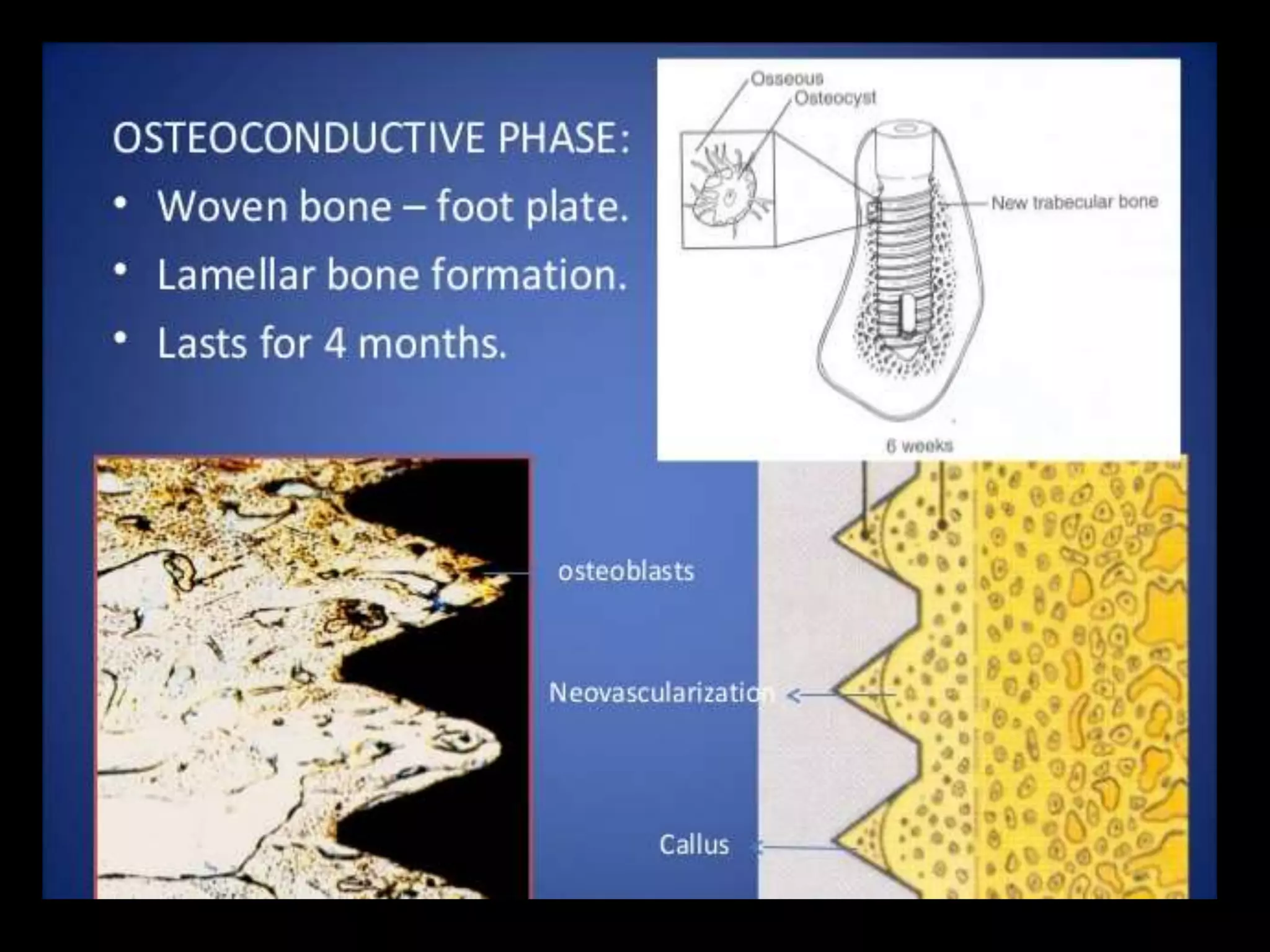 "OSSEOINTEGRATION" | PPTX