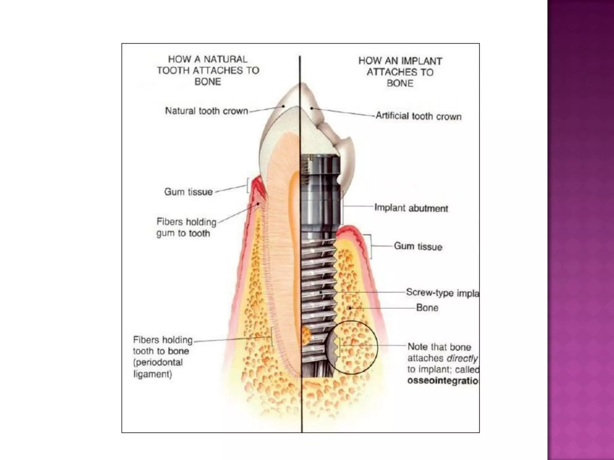 Osseointegration | PPT