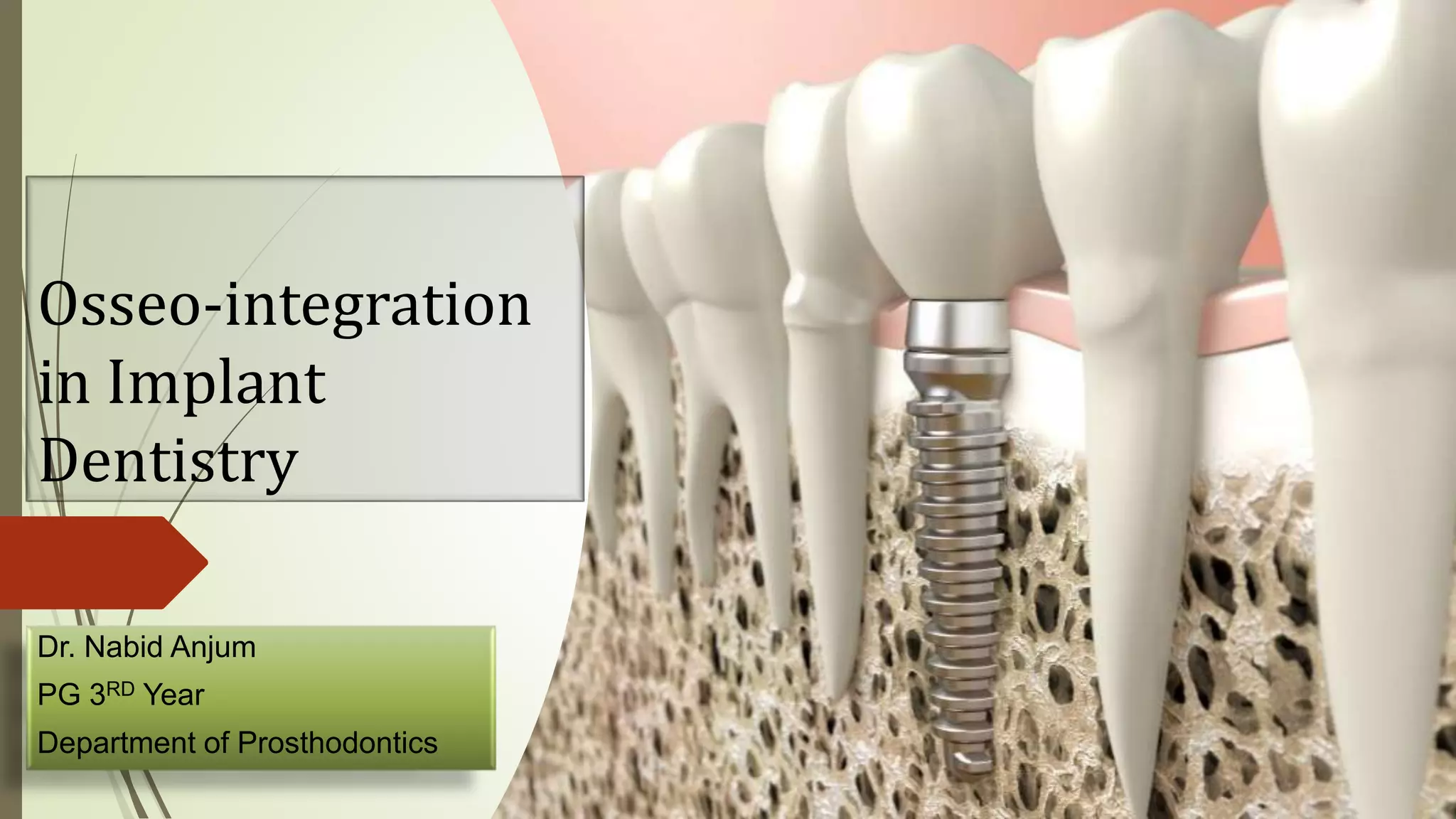 Osseointegration in Dental Implants | PPTX