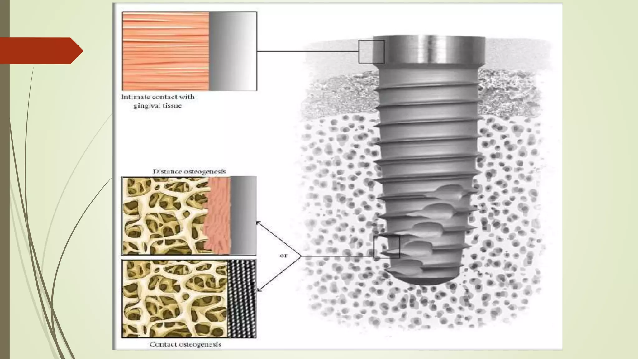 Osseointegration in Dental Implants | PPTX