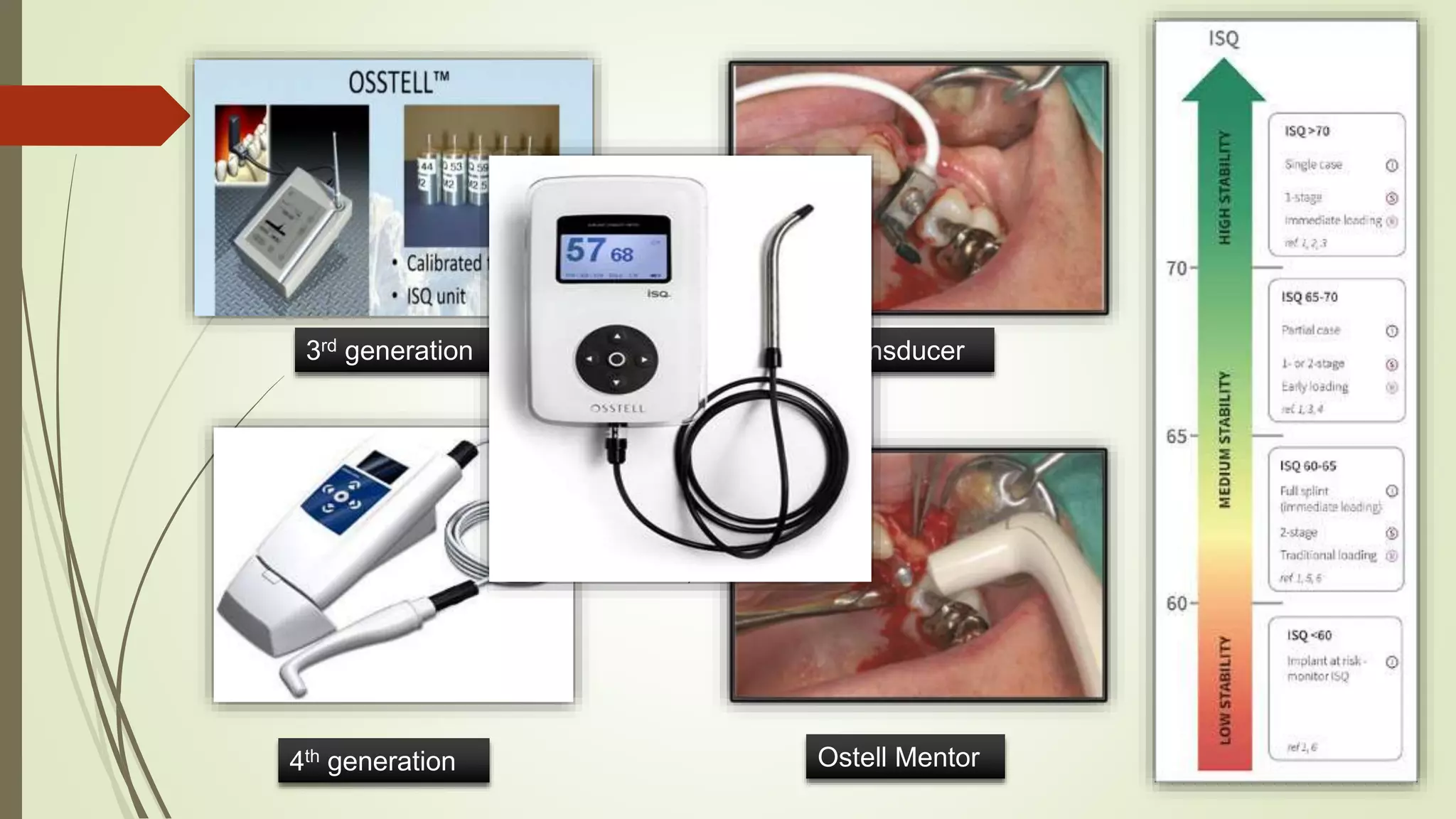 Osseointegration in Dental Implants | PPTX