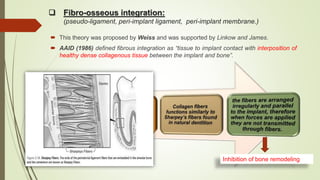 Osseointegration in Dental Implants | PPTX