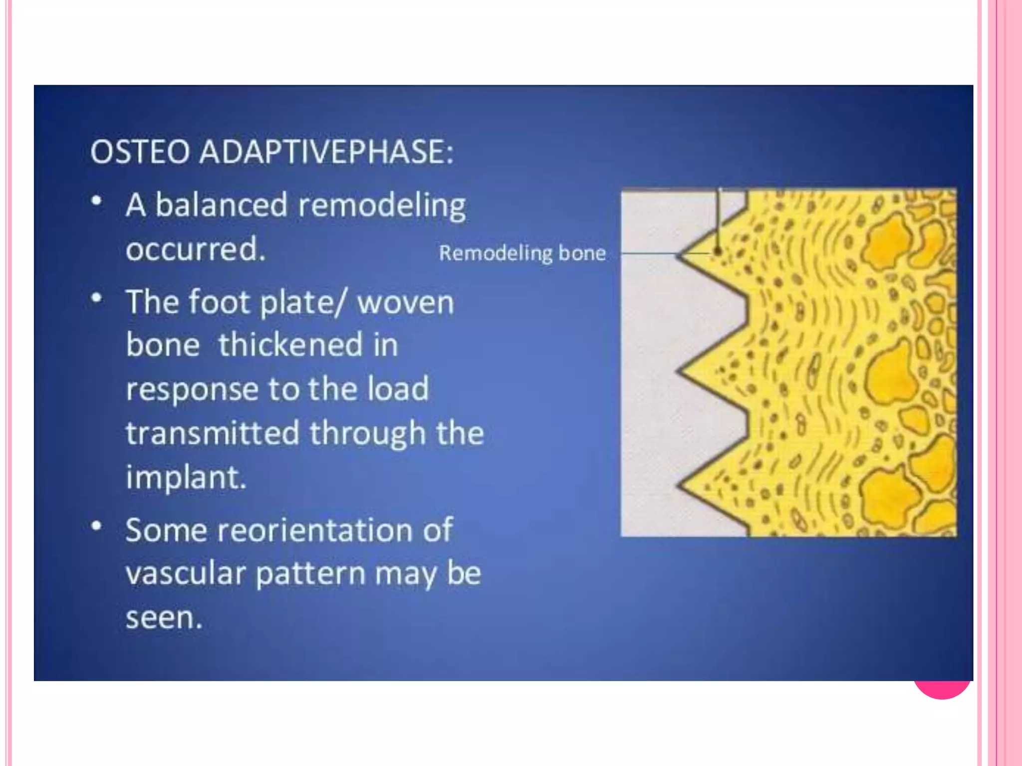 Osseointegration final | PPTX