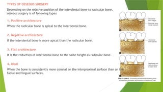 periodontal Osseous Surgery and its management.pptx
