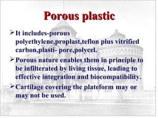 Ossicluloplasty in detail | PPT