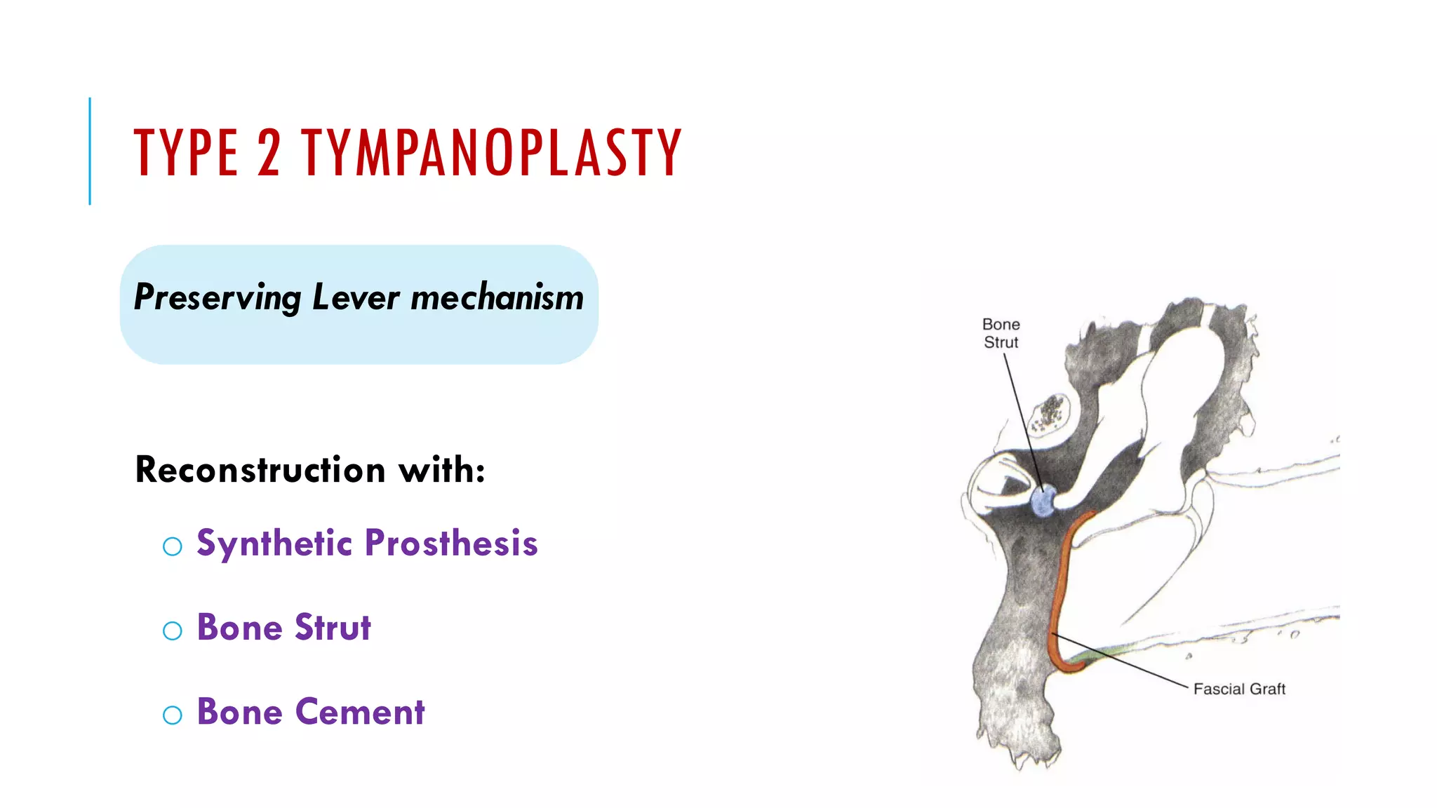 Tympanoplasty( Ossicular Chain Reconstruction) | PDF