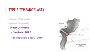 Tympanoplasty( Ossicular Chain Reconstruction) | PDF