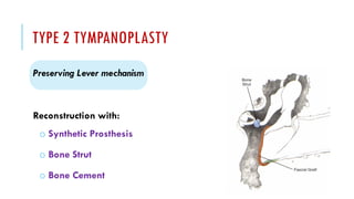 Tympanoplasty( Ossicular Chain Reconstruction) | PDF