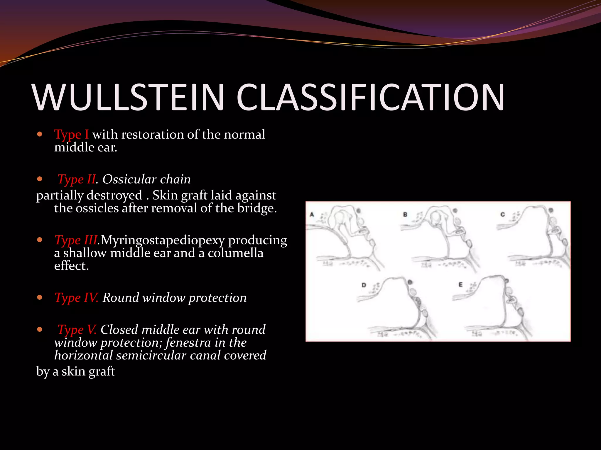 Ossiculoplasty | PPTX