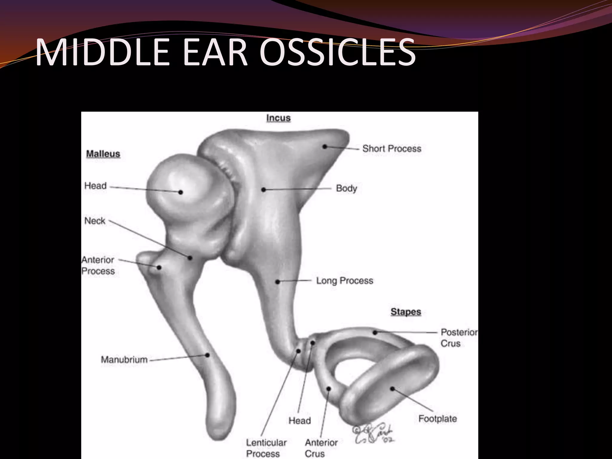 Ossiculoplasty | PPTX