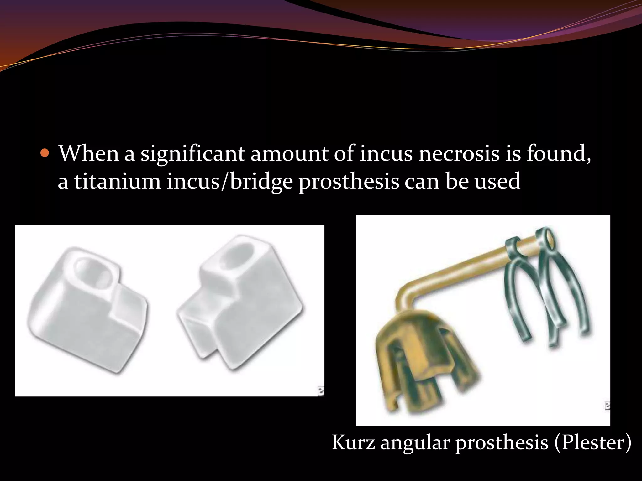 Ossiculoplasty | PPTX