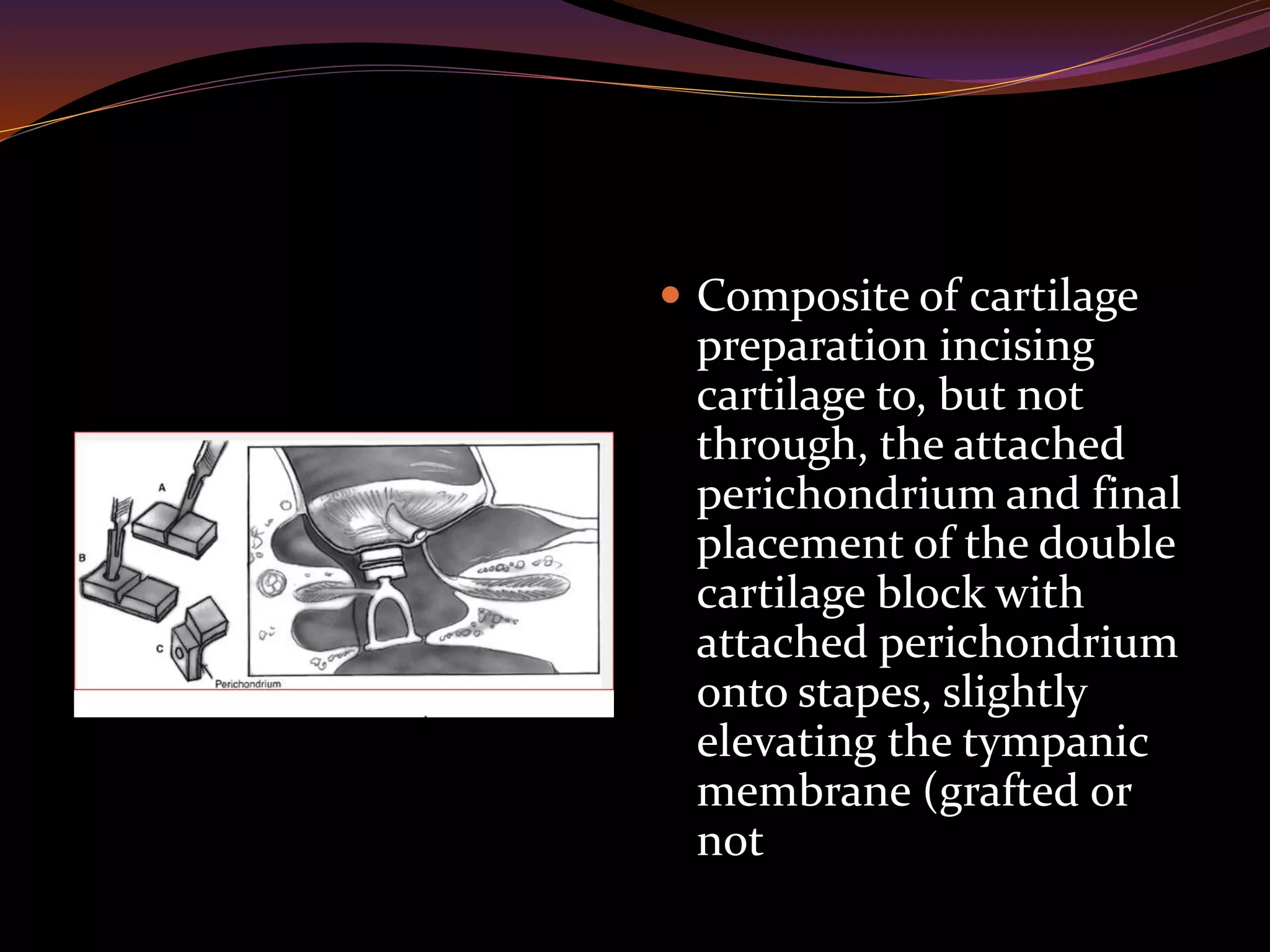 Ossiculoplasty | PPTX