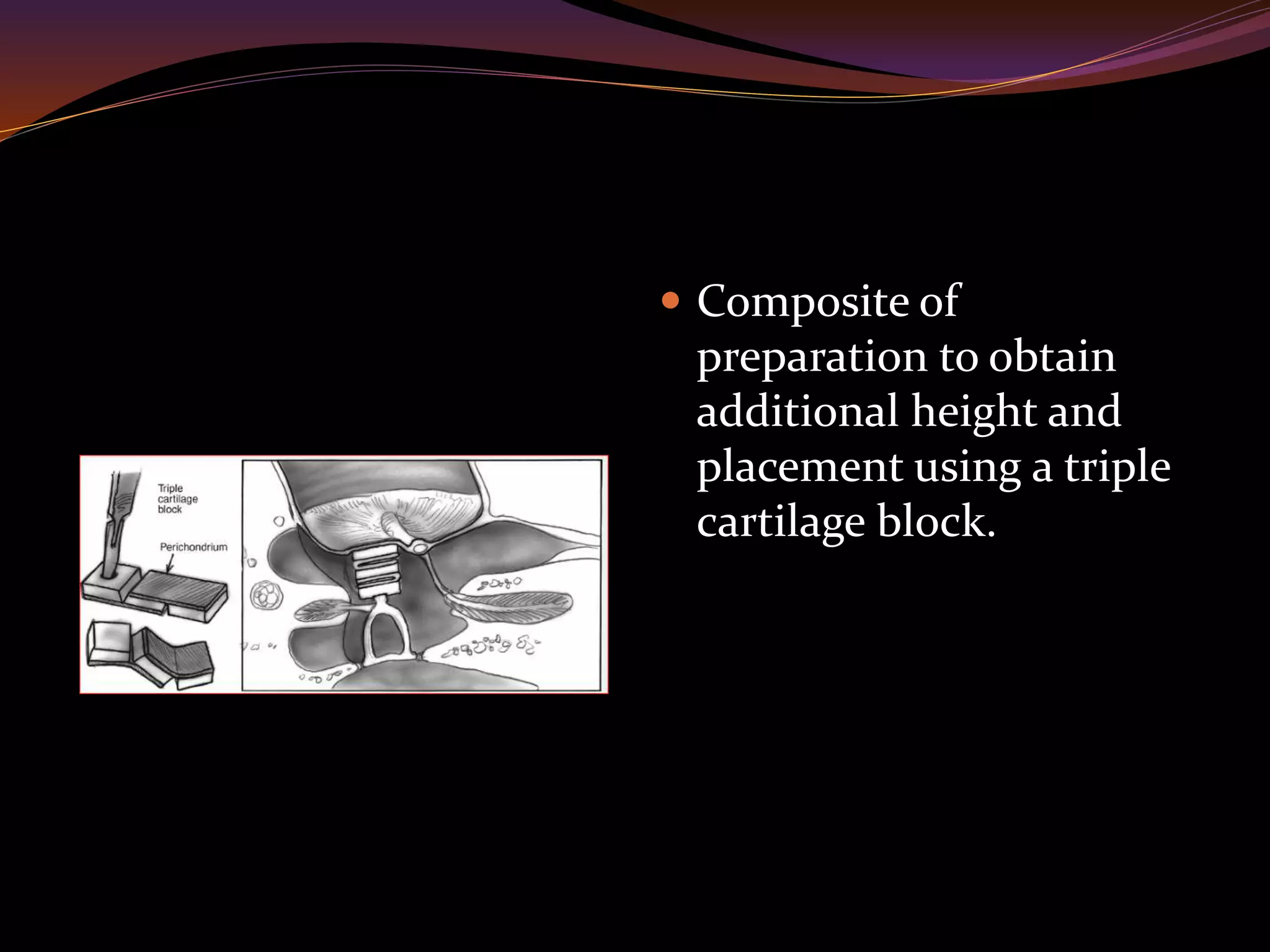 Ossiculoplasty | PPTX
