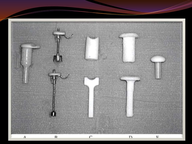Ossiculoplasty | PPTX | Ear, Nose and Throat Conditions | Diseases and ...