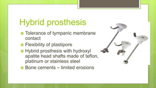 Ossiculoplasty | PPTX