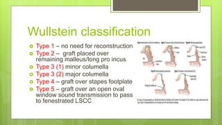 Ossiculoplasty | PPT